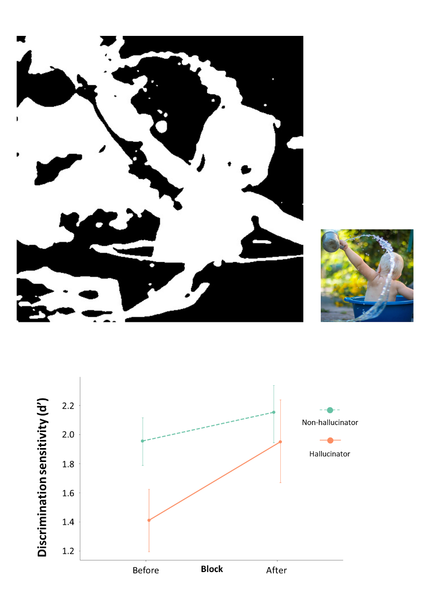 Visual hallucinations in Parkinson’s disease: towards better ...